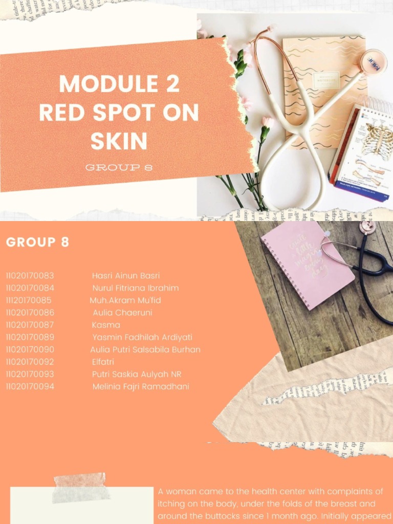 PBL Modul 2 Tropis | PDF | Candidiasis | Medical Specialties