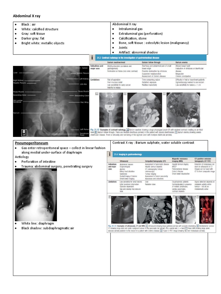 Abdominal X Ray | PDF | Esophagus | Gastroenterology