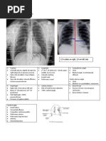Ecg Interpretation J Point Stemi Criteria Equivalents and Others | PDF ...