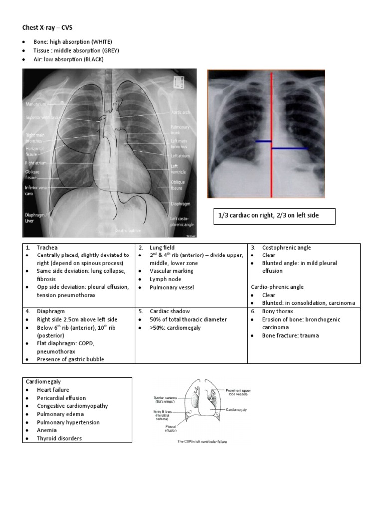 Chest X-Ray - CVS: 1/3 Cardiac On Right, 2/3 On Left Side | PDF | Heart ...