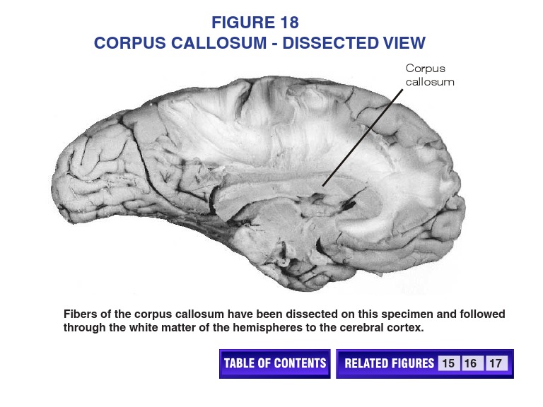 Dissected View of Corpus Callosum | PDF