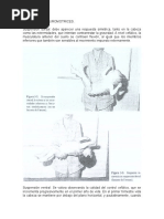 Tecnicas de Kabat y Bobath | PDF | Músculo | Contracción muscular