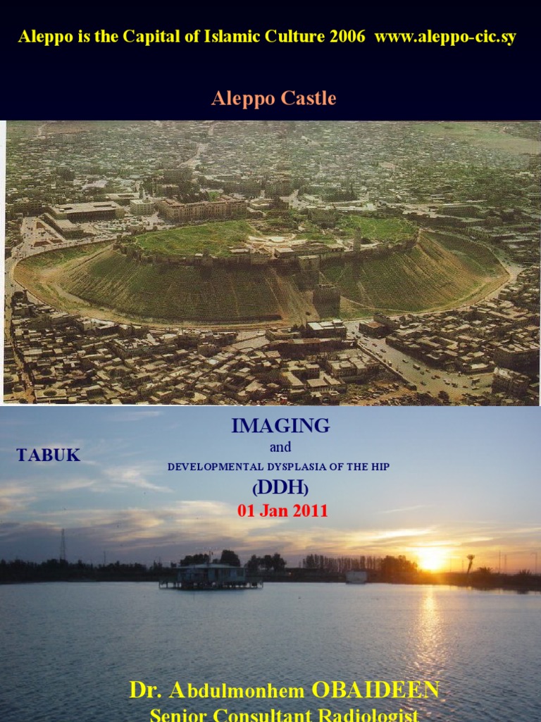 DDH Ortho. 01-01-2011 | PDF | Hip | Musculoskeletal System