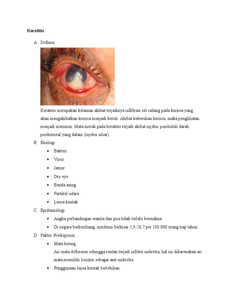 Keratitis | PDF | Kesehatan Holistik