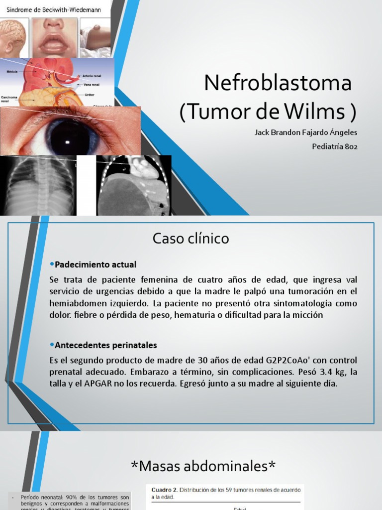 Nefroblastoma: Diagnóstico y Tratamiento | PDF | Metástasis | Cáncer