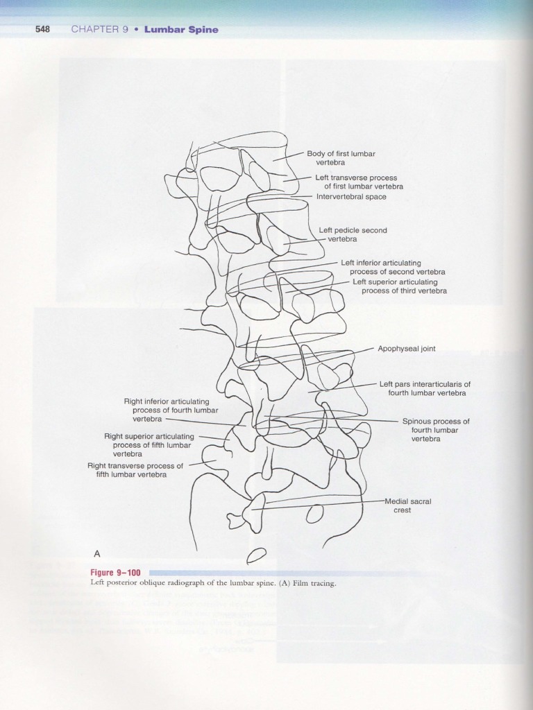 Lumbar Spine Anatomy and Common Pathologies | PDF | Anatomical Terms Of ...