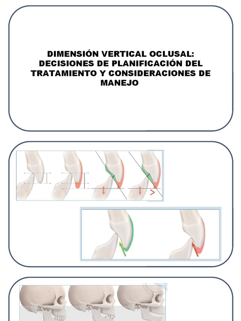 Aumento Dimension Vertical | PDF | Odontología | Bienestar