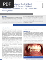 Prosthodontic Diagnostic Index (Pdi) For The Partially Edentulous and ...