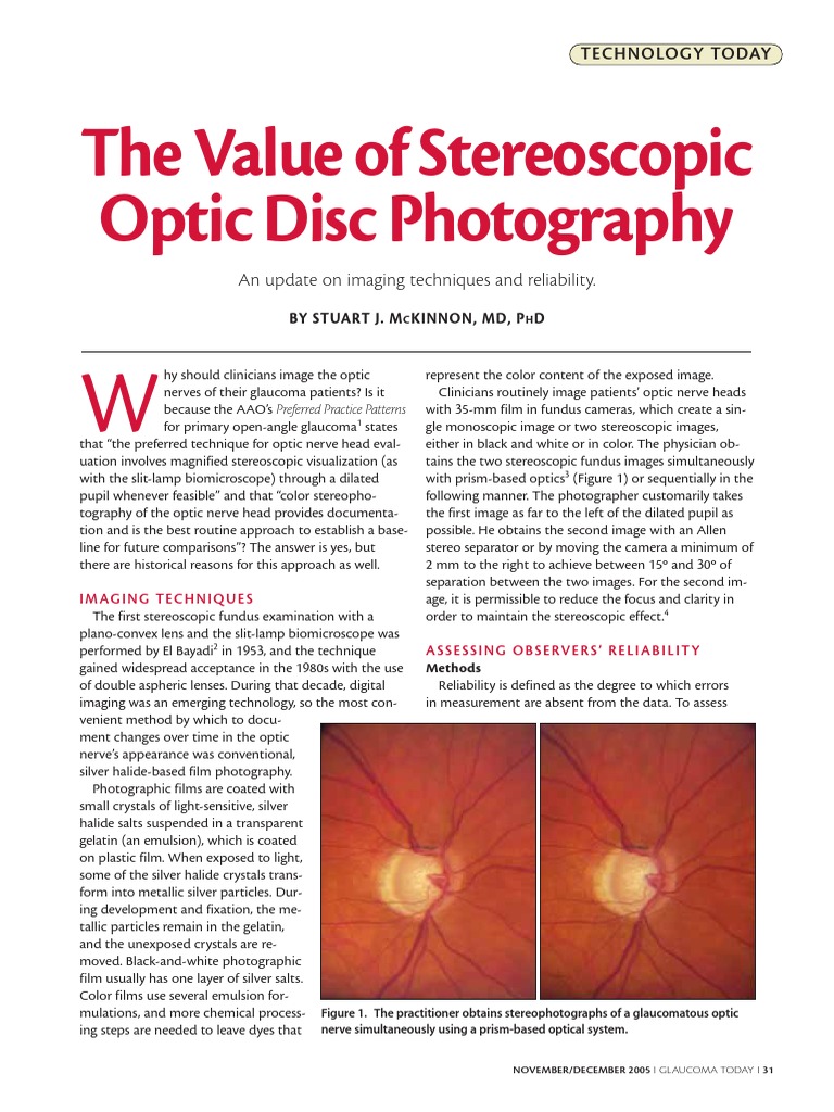 The Value of Stereoscopic Optic Disc Photography: An Update On Imaging ...