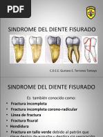 Furca Clasificación y Tratamiento | PDF | Especialidades Medicas ...