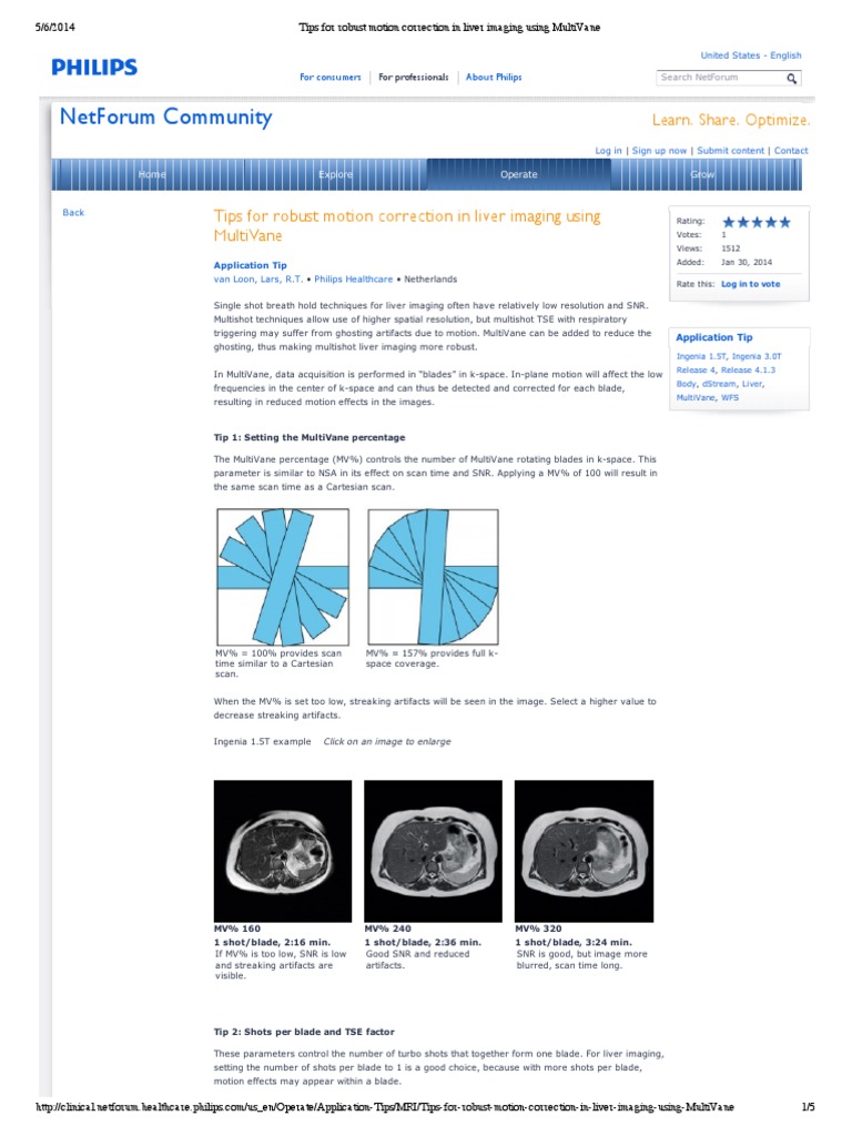 Tips For Robust Motion Correction in Liver Imaging Using Multivane ...