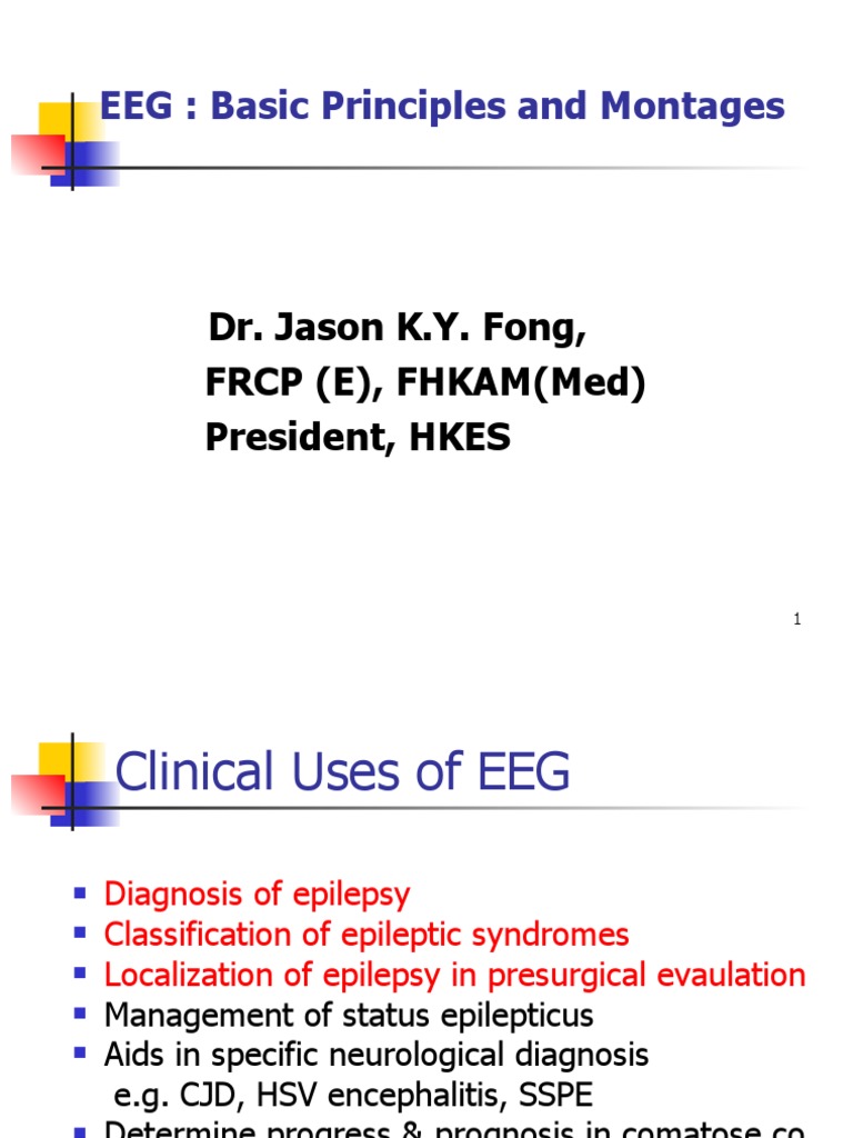 EEG - Basic Principles and Application in Epilepsy | PDF ...