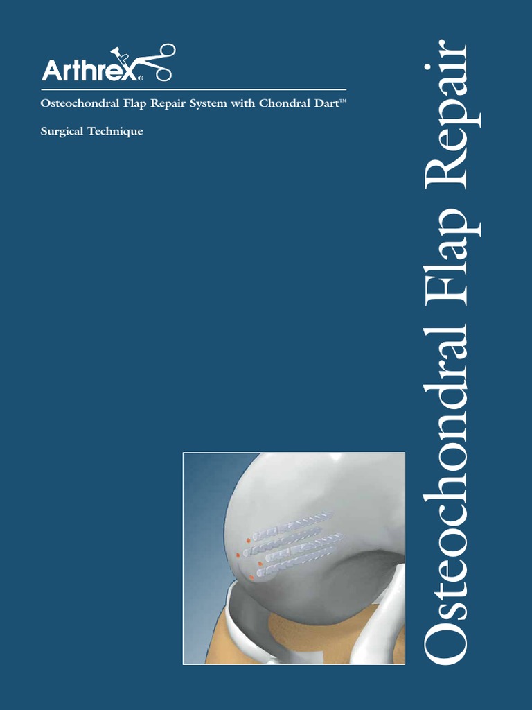 Osteochondral Flap Repair System With Chondral Dart™ | PDF | Cartilage ...
