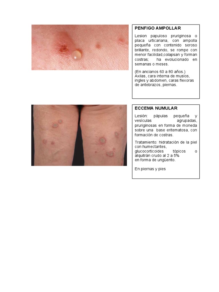 Topografia Derma Expo | PDF | Enfermedades y trastornos | Condiciones ...
