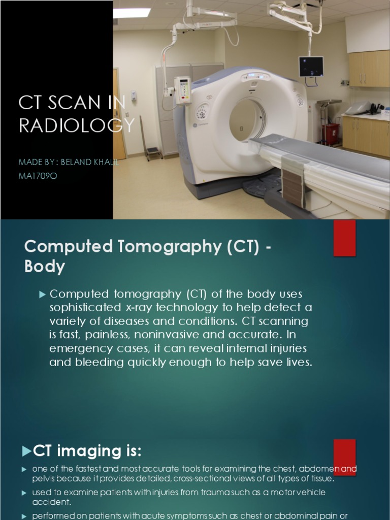 CT Scan in Radiology: Made By: Beland Khalil MA1709O | PDF | Ct Scan ...