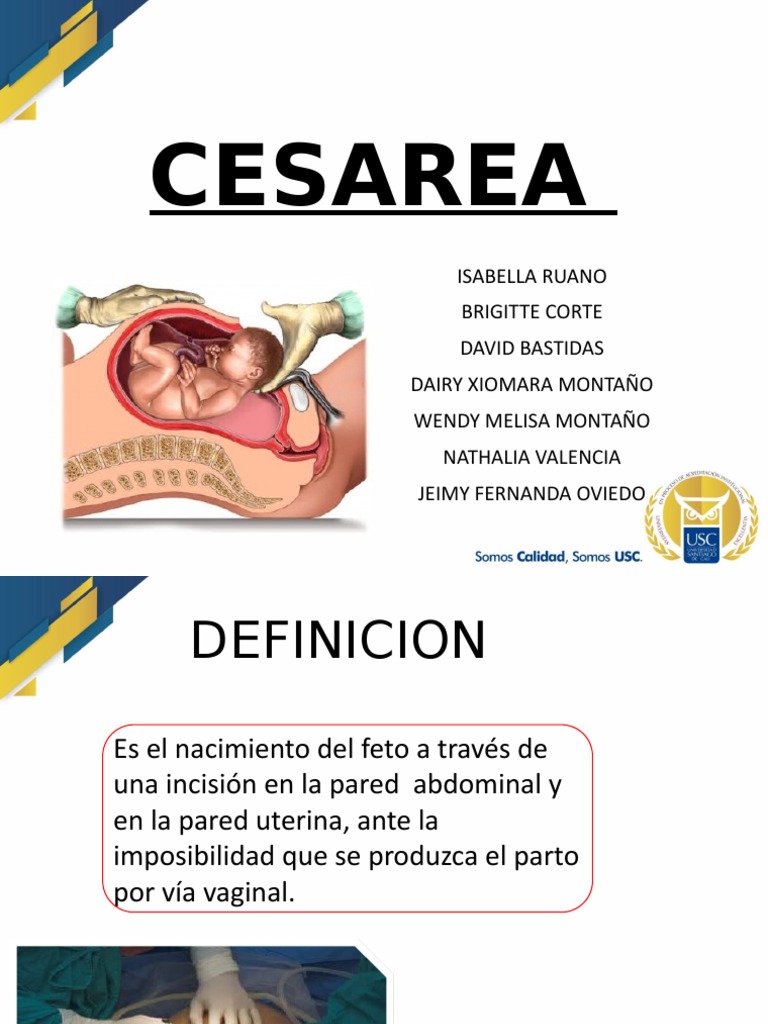 Complicaciones y tipos de cesárea | PDF | Parto | Placenta