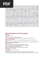 Delta Wave - LITFL Medical Blog - ECG Library Basics | PDF | Cardiac ...