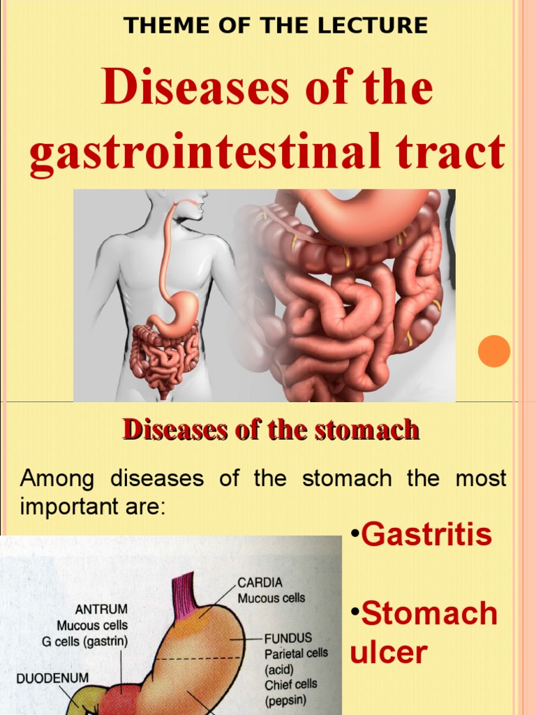 Gastric Diseases: Gastritis, Ulcers, Cancer | PDF | Gastrointestinal ...