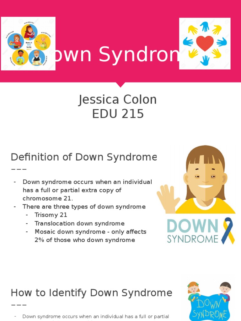 Down Syndrome | PDF | Down Syndrome | Diseases And Disorders