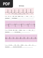 ECG Arrhythmias: PAC, PJC, PVC Guide | PDF | Cardiac Electrophysiology ...