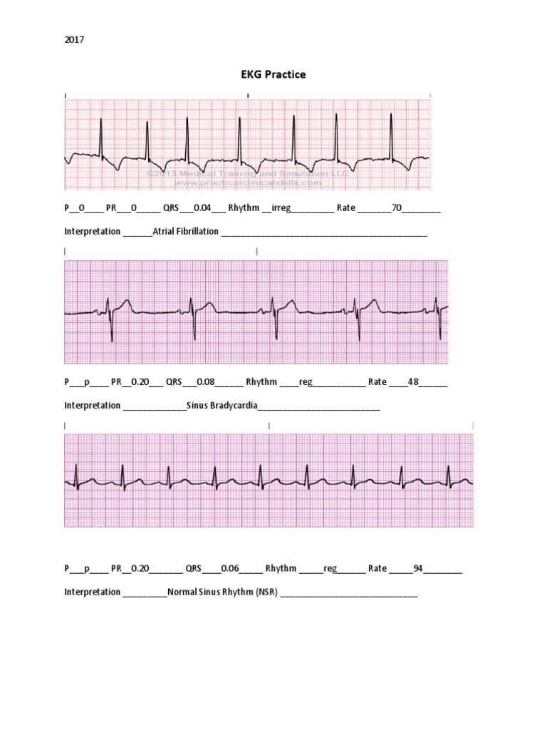 EKG Practice 2 - Answers | PDF | Electrocardiography | Cardiology