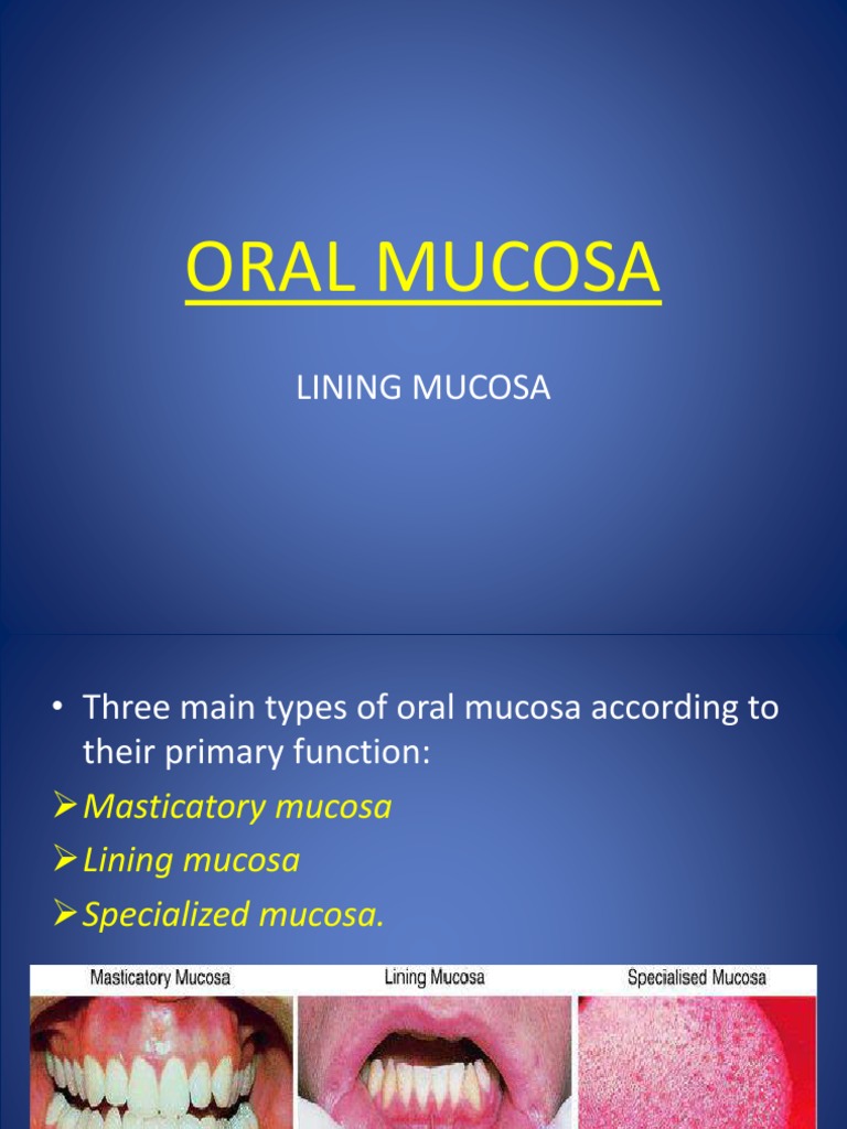 Masticatory Mucosa