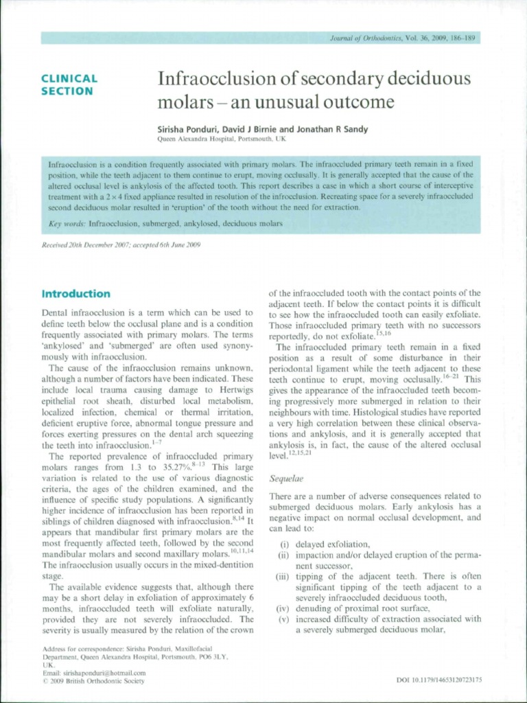 Infraocclusion of Secondary Deciduous | PDF | Human Tooth | Dental Anatomy