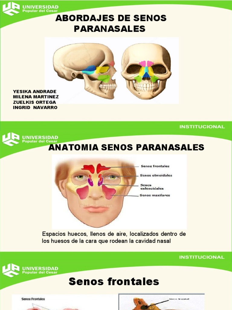 Abordajes De Senos Paranasales Exp Pdf Cabeza Y Cuello Humanos