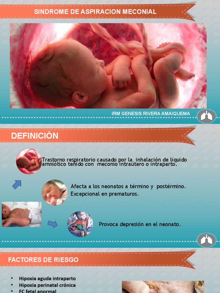Síndrome de Aspiración Meconial: Guía Clínica | PDF | Ciencias de la ...