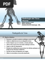 Radiografía de Tórax Normal - Patrón Intersticial | PDF | Pulmón | Tórax