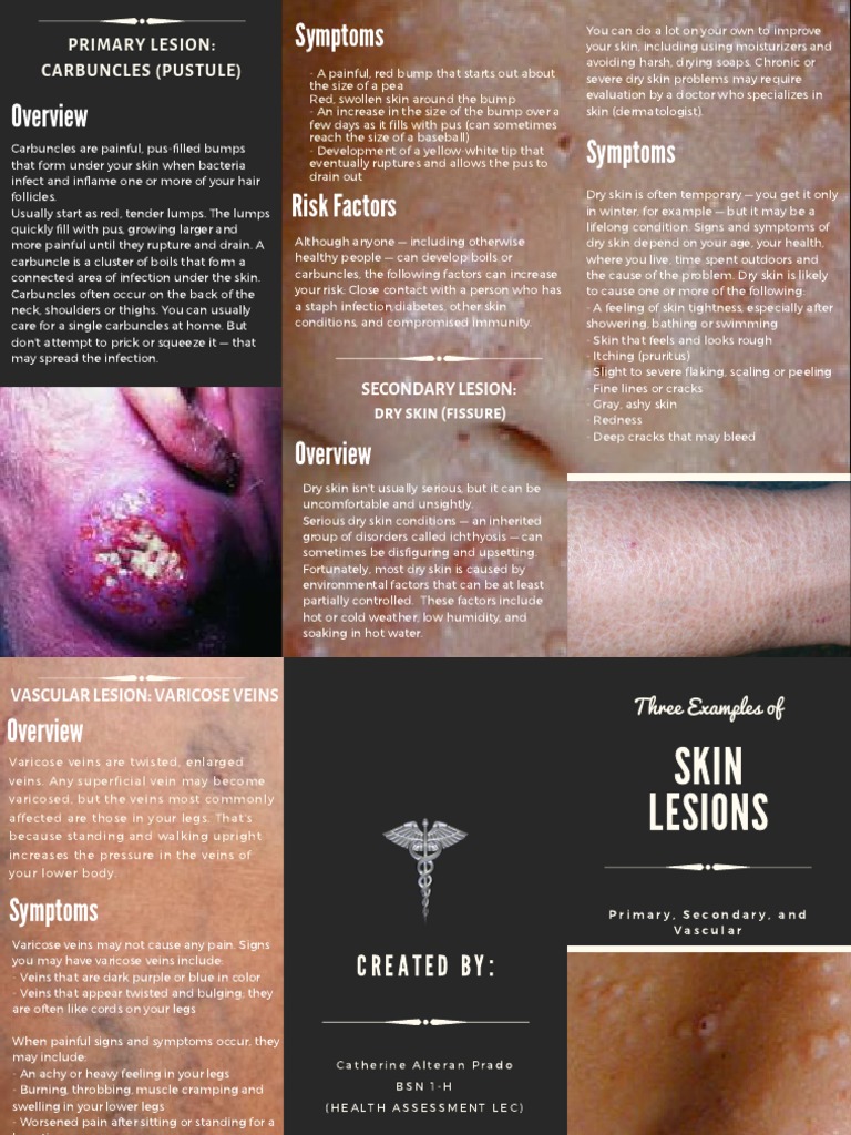 Primary Lesion: Carbuncles (Pustule) : Secondary Lesion: Dry Skin ...
