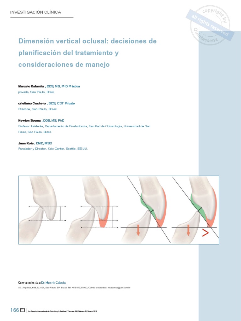 DIMENSION VERTICAL - En.es PDF | PDF | Dentadura postiza | Odontología