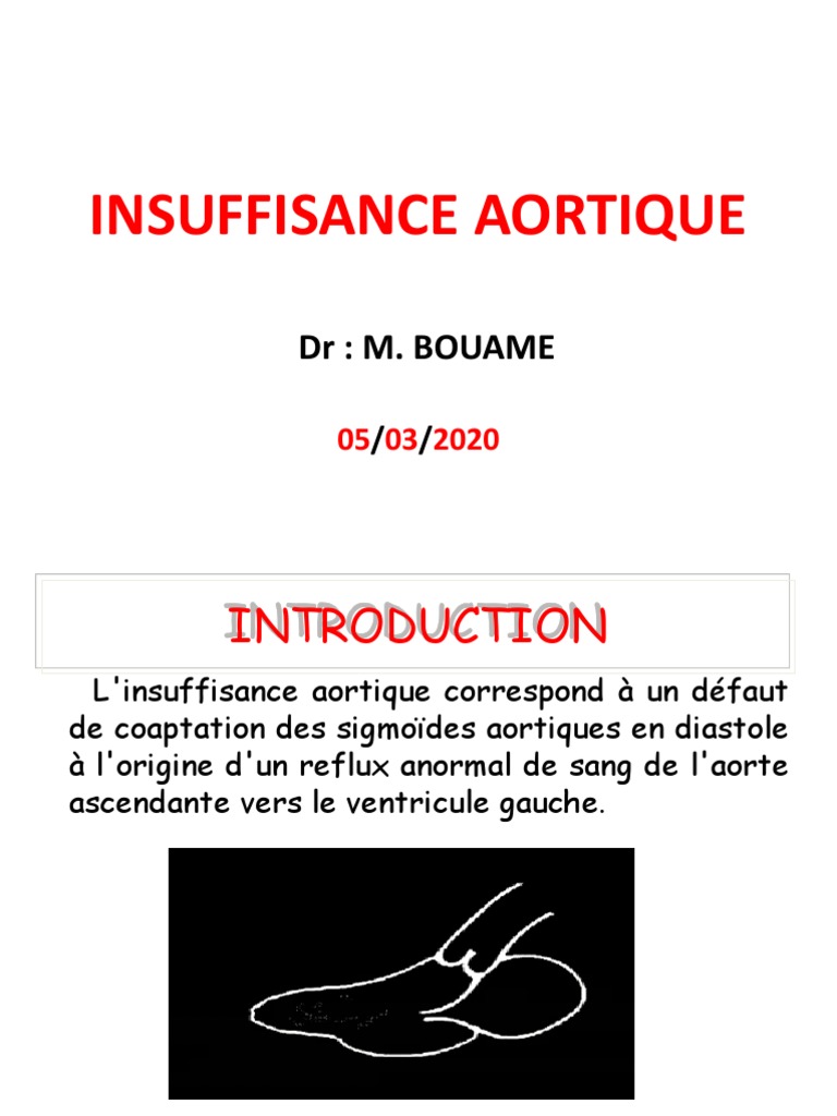 Insuffisance Aortique : Diagnostic et Traitement | PDF | Aorte | Angiologie