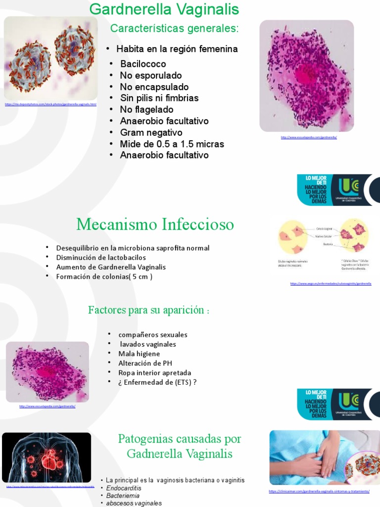 Gardnerella Vagnalis | PDF | Inmunología | Medicina CLINICA