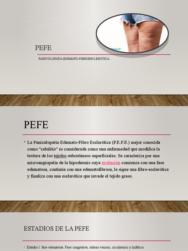 Grados y tipos de PEFE: Celulitis | PDF | Piel | Tejido adiposo