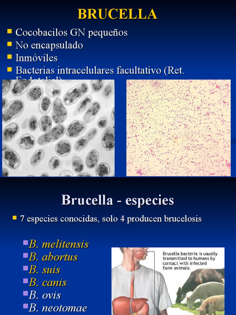 Características de Brucella y Brucelosis | PDF | Especialidades Medicas ...