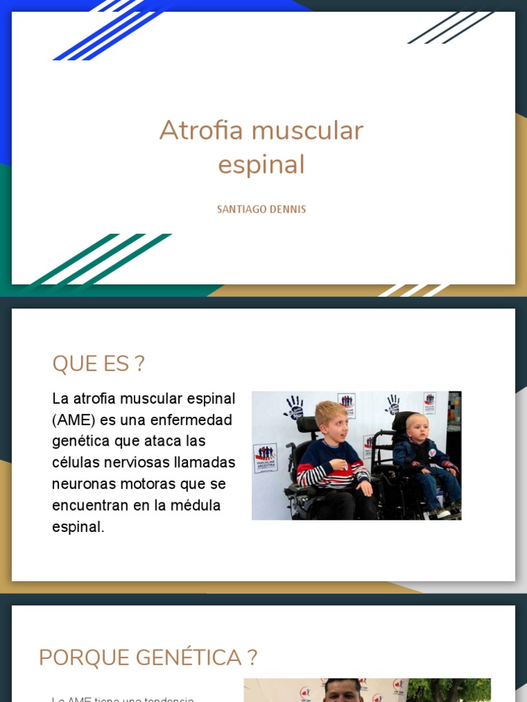 Atrofia Muscular Espinal PDF | PDF