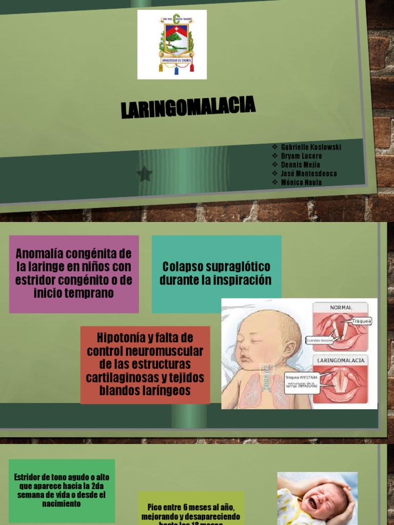 Laringomalacia | PDF | Rtt | Especialidades Medicas