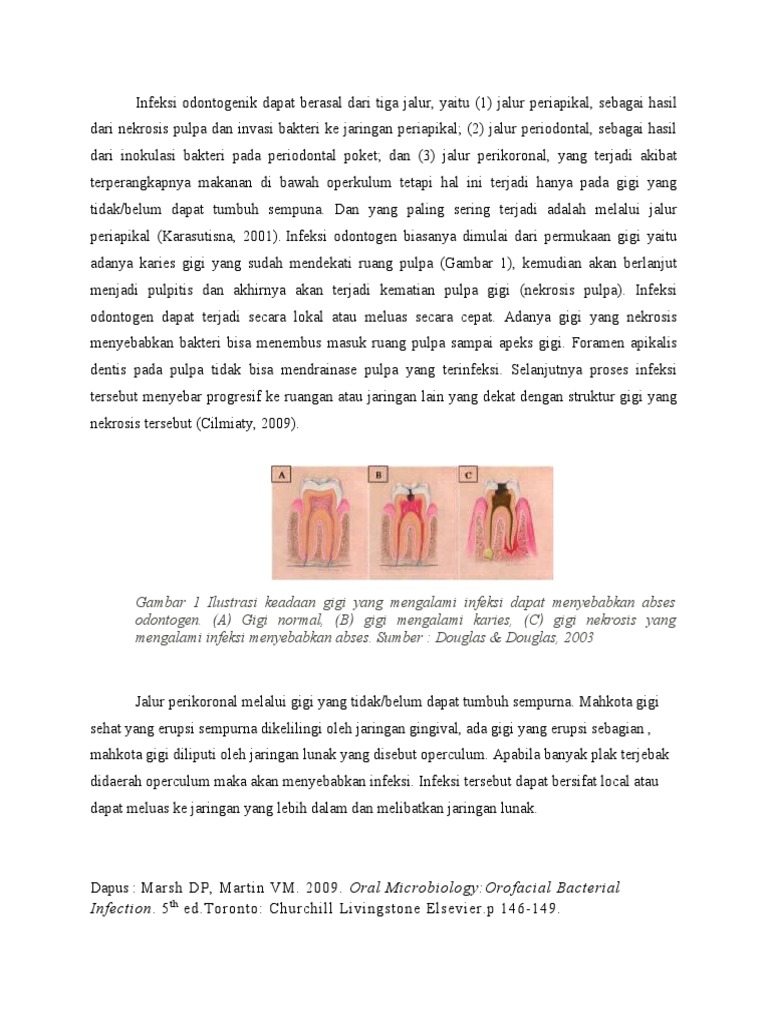 Infeksi Odontogenik Dapat Berasal Dari Tiga Jalur | PDF