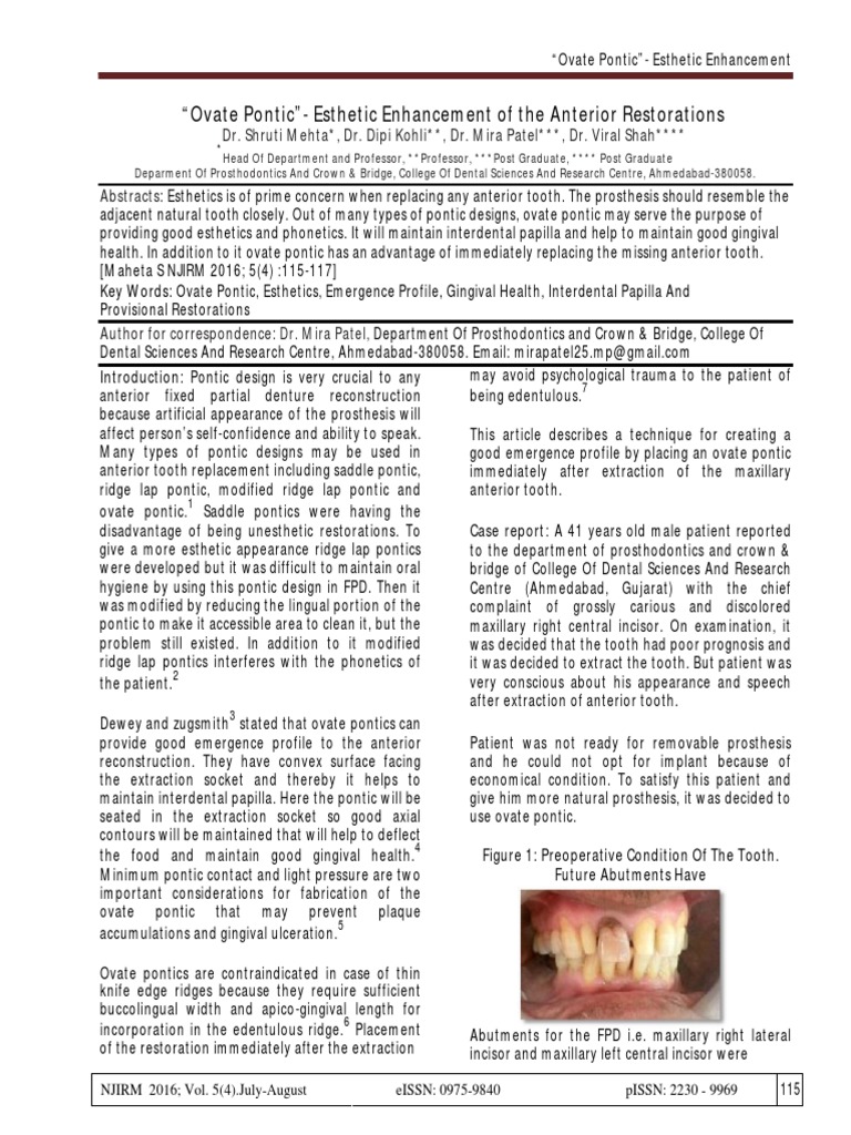 Ovate Pontic Design: An Immediate Solution for Esthetic Replacement of ...