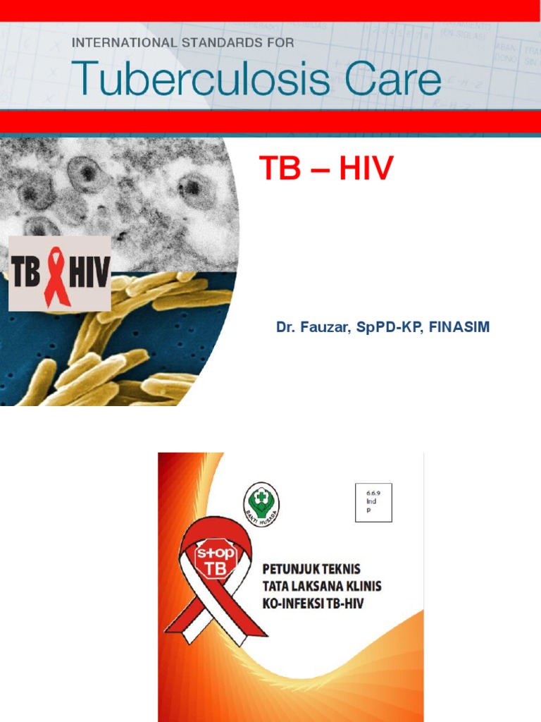 TB Hiv | PDF