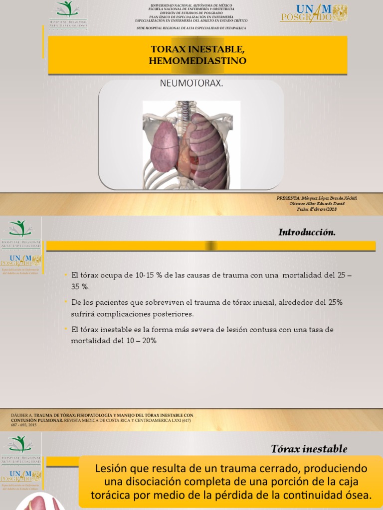 Torax Inestable y Hemomediastino | PDF | Analgésico | Tórax