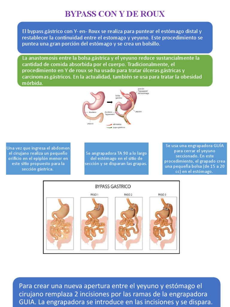 Bypass Con y de Roux | PDF | Salud y bienestar