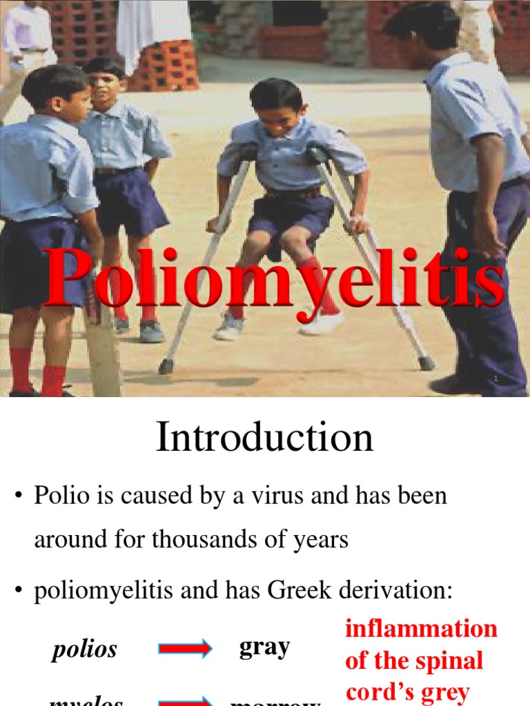 Poliomyelitis