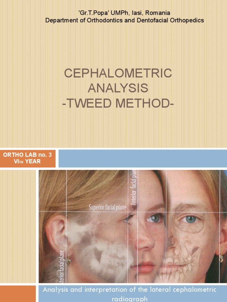 LP 3 - Cephalometric TWEED Analysis | PDF | Human Nose | Human Anatomy