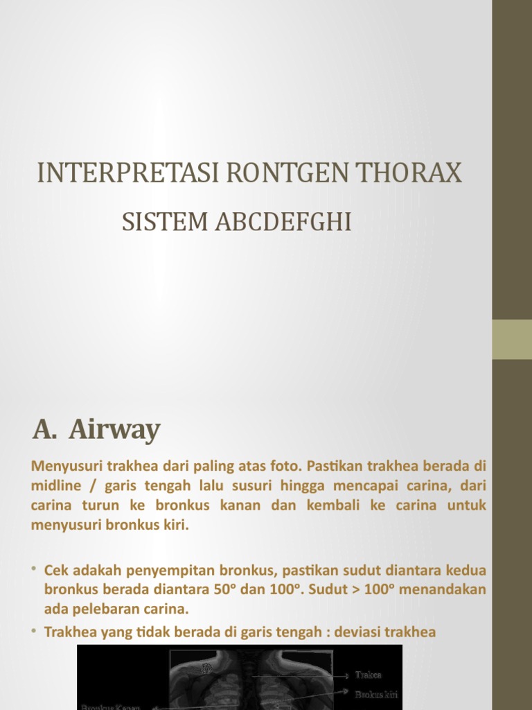 Interpretasi Rontgen Thorax | PDF