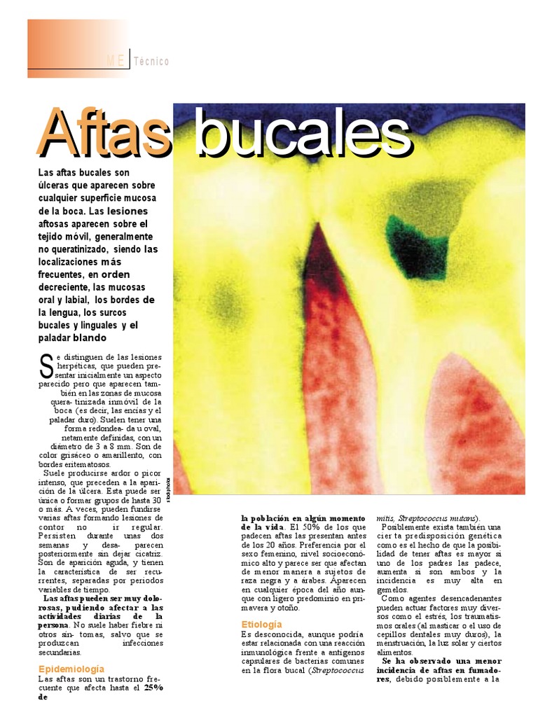 Aftas Bucales: Causas y Tratamientos | PDF | Epidemiología ...