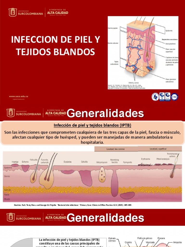 Infección de Piel y Tejidos Blandos | PDF | Epidemiología | Inmunología