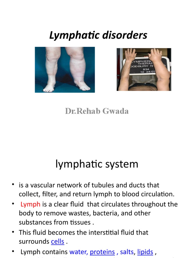 Lymphatic Disorders: DR - Rehab Gwada | PDF | Lymphatic System | Lymph Node