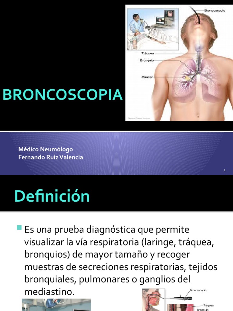 Anatomía Bronquial Broncoscopia